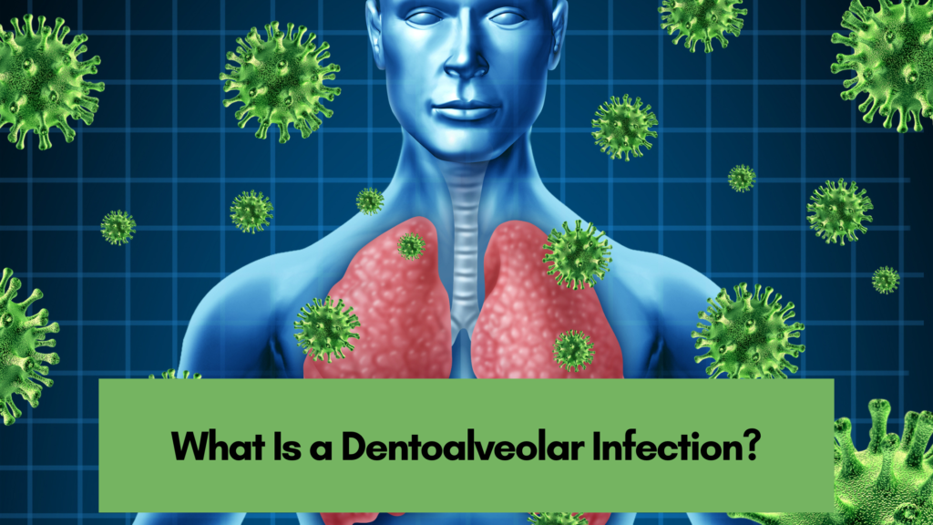 What Is a Dentoalveolar Infection?