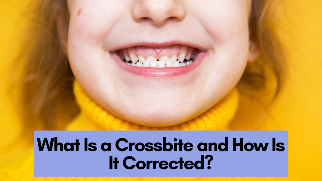 What Is a Crossbite and How Is It Corrected?